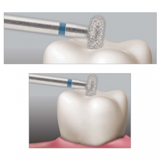 Diamond Bur Wheel | J&S Davis