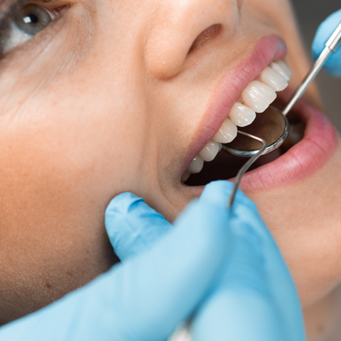 Benefits Dental Implants | J&S Davis